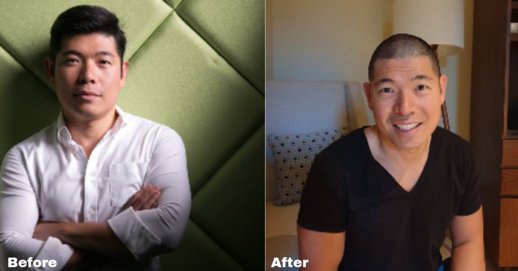 Grab’s Anthony Tan Goes Bald For Cancer - CodeBlue